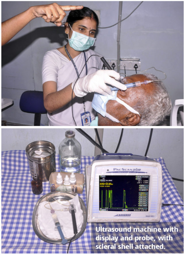 PHFI CEHJ » Using a quality improvement process to improve cataract ...