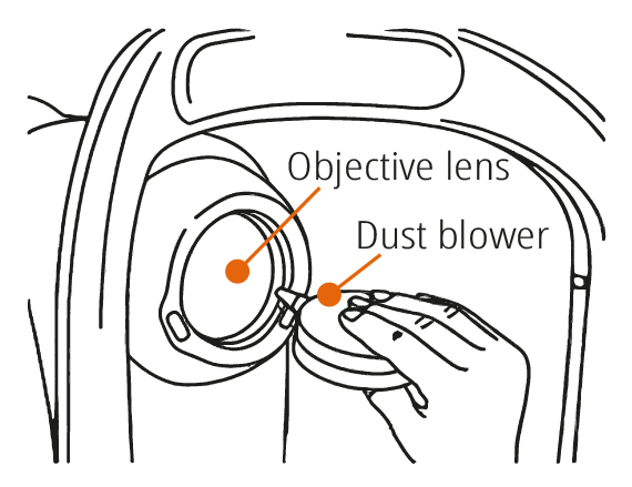Caring for a retinal camera - CEHJ, SA