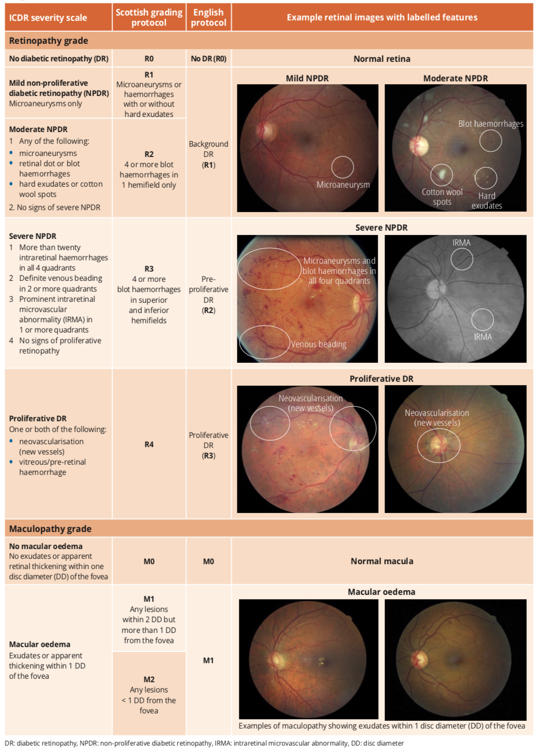 PHFI CEHJ » Comparing the International Clinical Diabetic Retinopathy (ICDR) severity scale