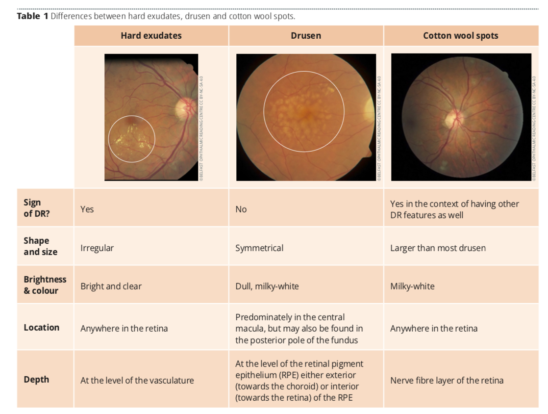 Grading images for diabetic retinopathy: tips and guidelines - CEHJ, SA