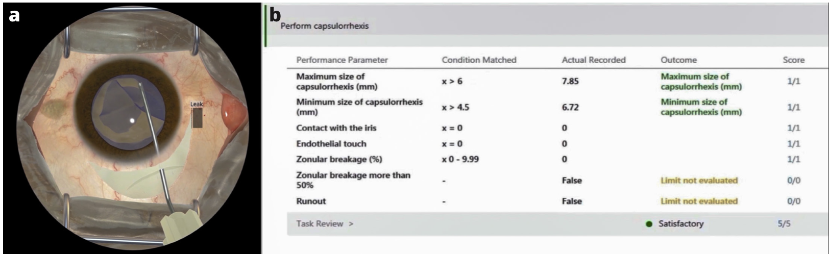 More than simulation: the HelpMeSee approach to cataract surgical ...