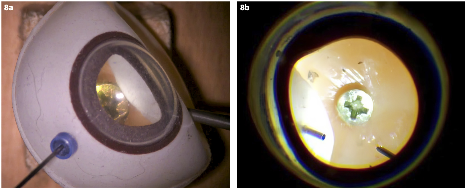 Vitreoretinal surgery: an introduction to simulation training - CEHJ, SA