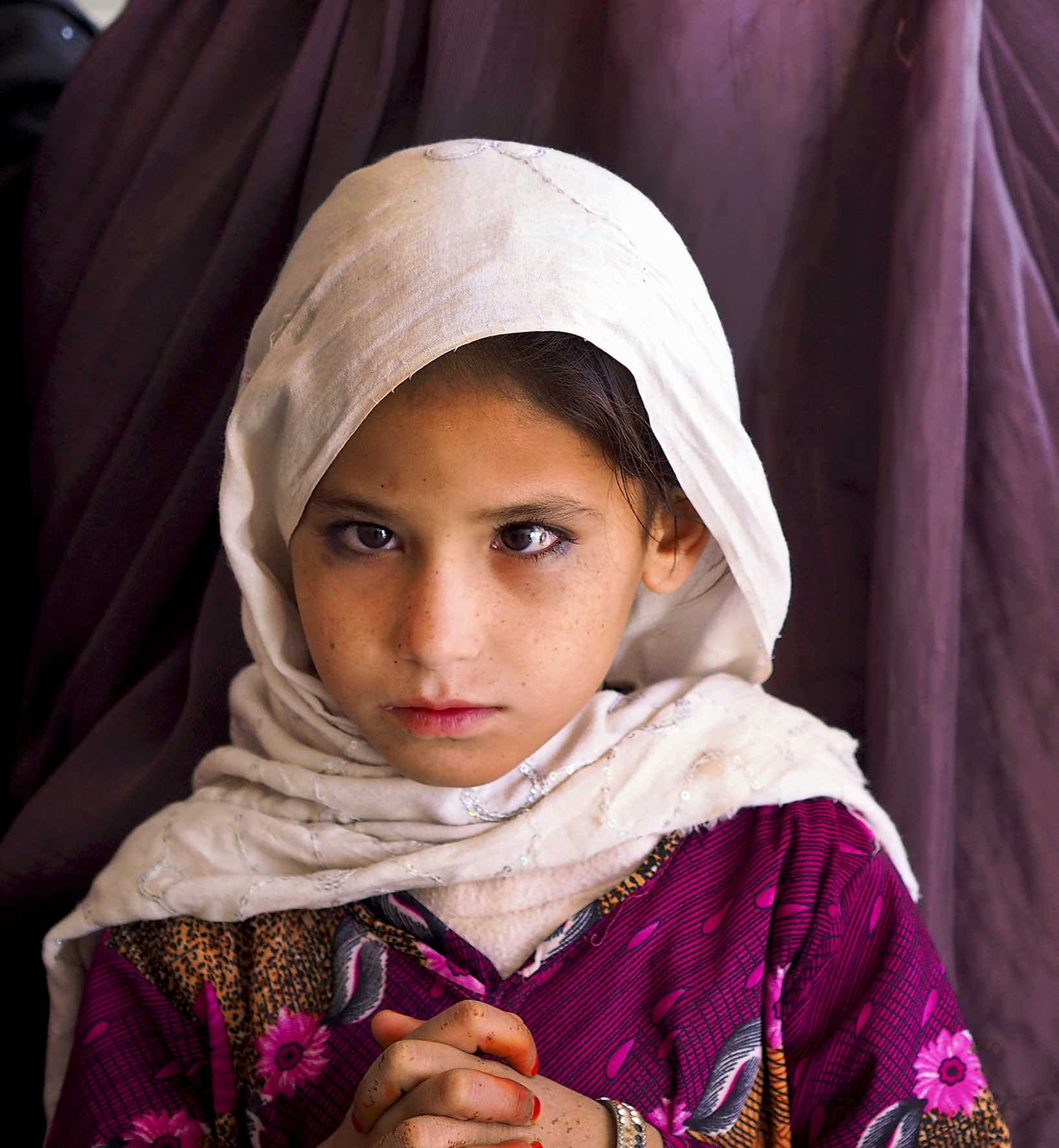 PHFI CEHJ » Common eye conditions in children: care and referral at ...