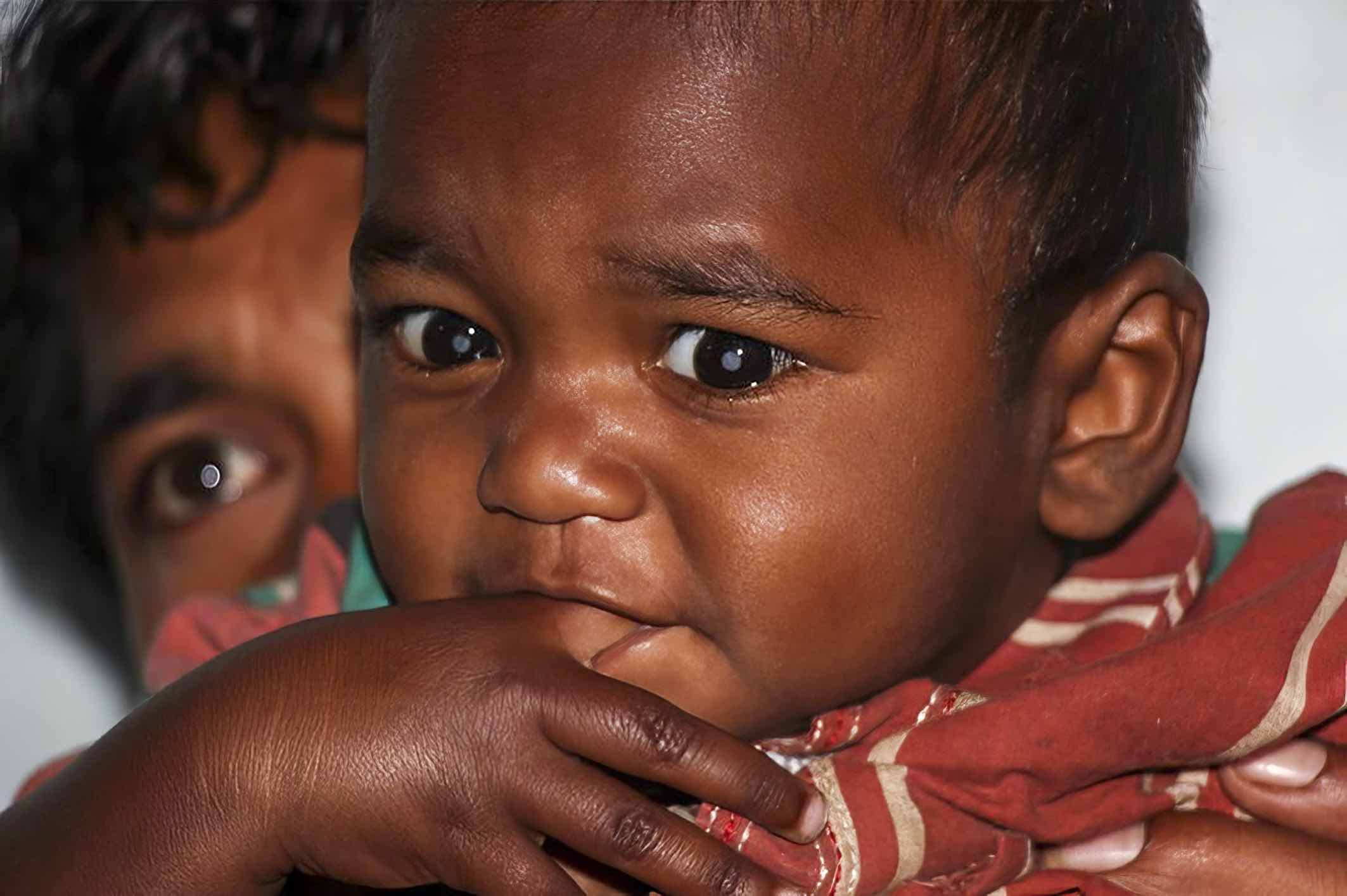 PHFI CEHJ » Common eye conditions in children: care and referral at ...