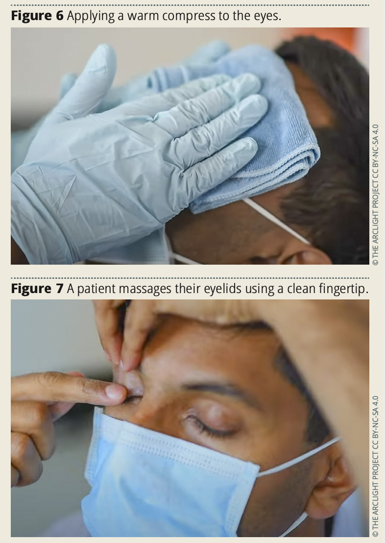 PHFI CEHJ » Dry eye disease: an introduction